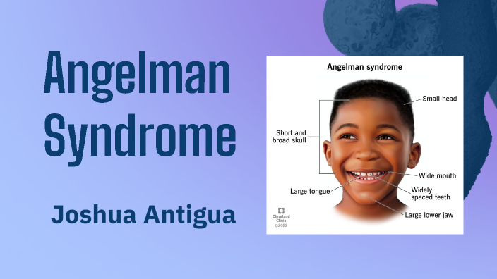 Angelman Syndrome (Antigua) by Joshua Antigua on Prezi