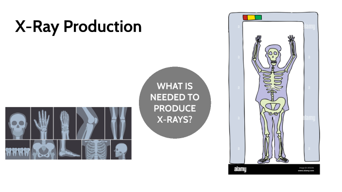 X-Ray Production by Cameron Mckenzie on Prezi