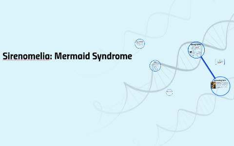 Sirenomelia: Mermaid Syndrome by on Prezi
