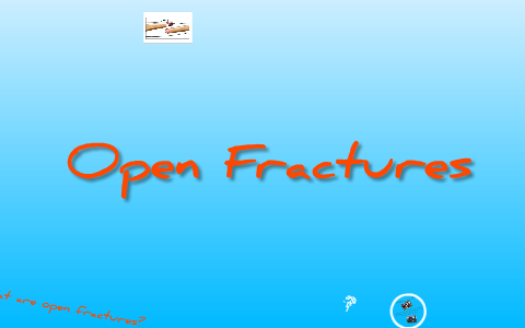 Open Fractures by Ryniah Dumas on Prezi
