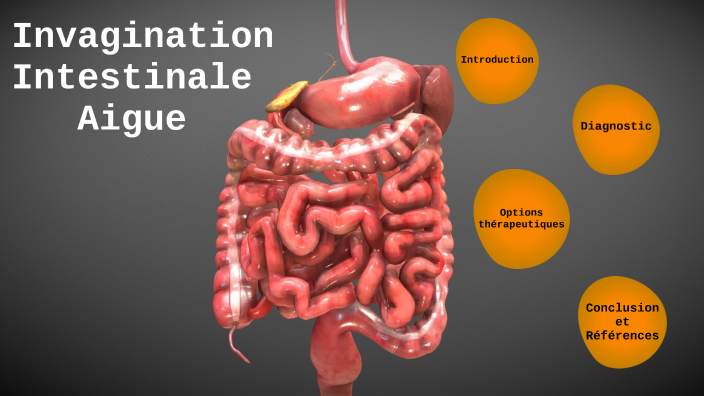 invagination intestinale aigue by mariam henane on Prezi