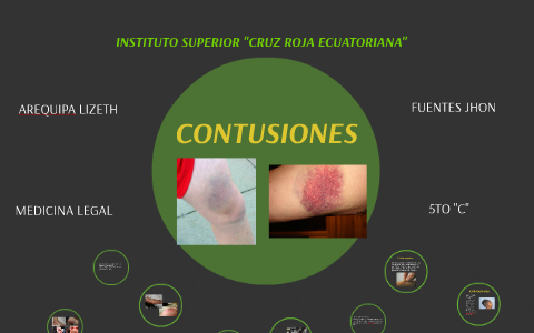 INSTITUTO SUPERIOR TECNOLOGICO "CRUZ ROJA ECUATORIANA" by Jhon Fuentes ...