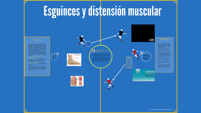 Esguinces y distensión muscular by Juan Montoya on Prezi