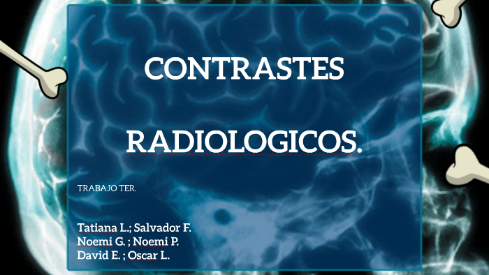 CONTRASTES RADIOLOGICOS. by DAVID ESPERANZA POLIT on Prezi