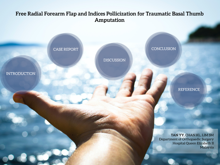 Free Radial Forearm Flap and Indices Pollicization for Traumatic Basal ...