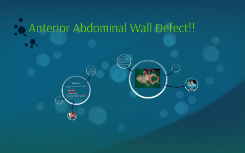 Anterior Abdominal Wall Defect!! by