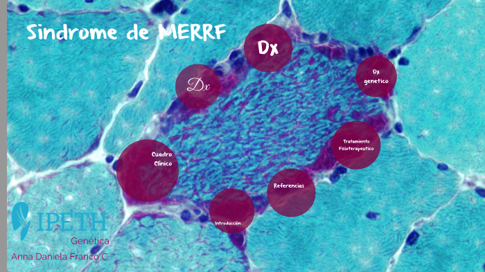 Sx de MERRF by Anna Franco on Prezi