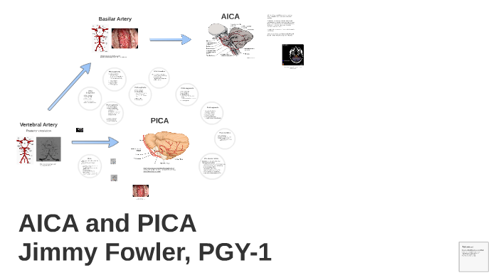 AICA and PICA by Jimmy Fowler on Prezi
