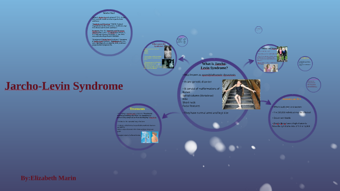 Jarcho-Levin Syndrome by elizabeth marin on Prezi