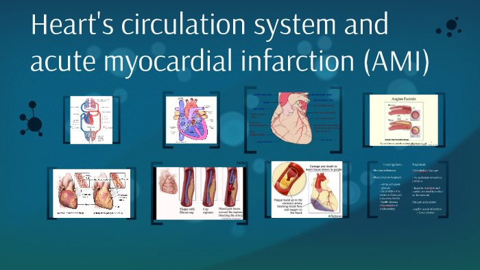 Heart's circulatory system and acute myocardial infarction by Samuli ...