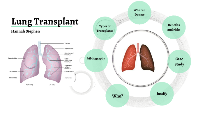 Organ Donation (Lung Transplant) by Hannah Stephen on Prezi