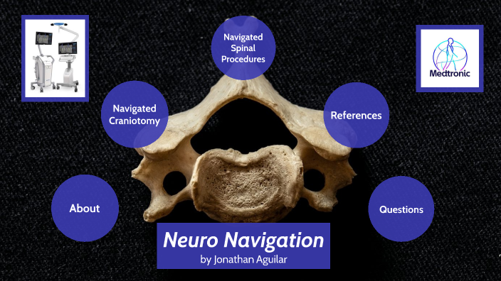 Neuro Navigation by Jonathan Aguilar on Prezi