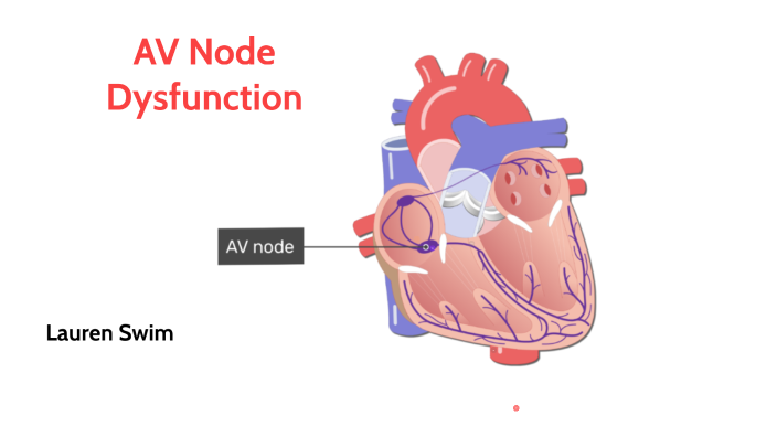 Overview of AV Node dysfunction by Lauren Swim on Prezi