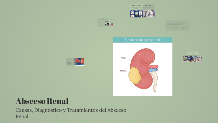 Absceso Renal by Jesus Navarro on Prezi