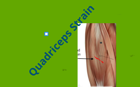 Quadricep Strain by Briana Burgan on Prezi