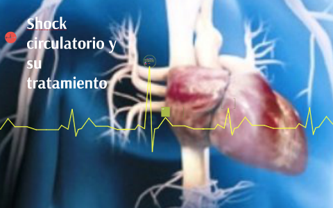 Shock circulatorio y su tratamiento by Cintya Zurita on Prezi