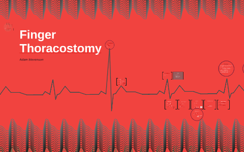 Finger Thoracostomy by Adam Stevenson on Prezi