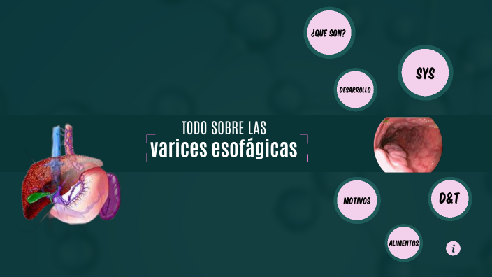 VARICES ESOFAGICAS by Cristina Maria Begnozzi Guart on Prezi