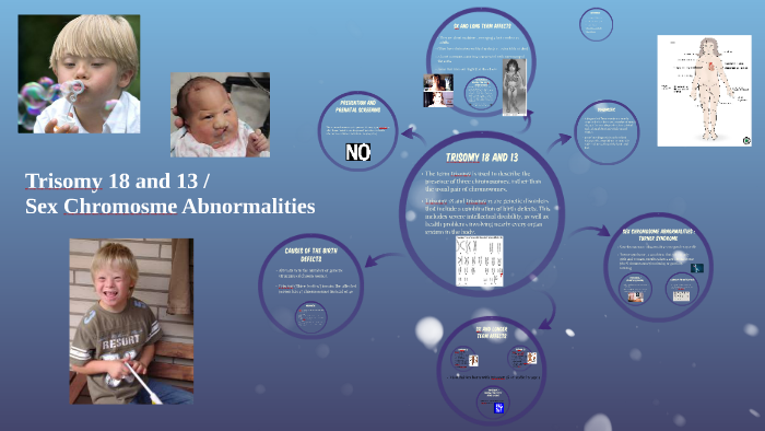 Trisomies 18 and 13 / Sex Chromosome Abnormalities by B Y on Prezi