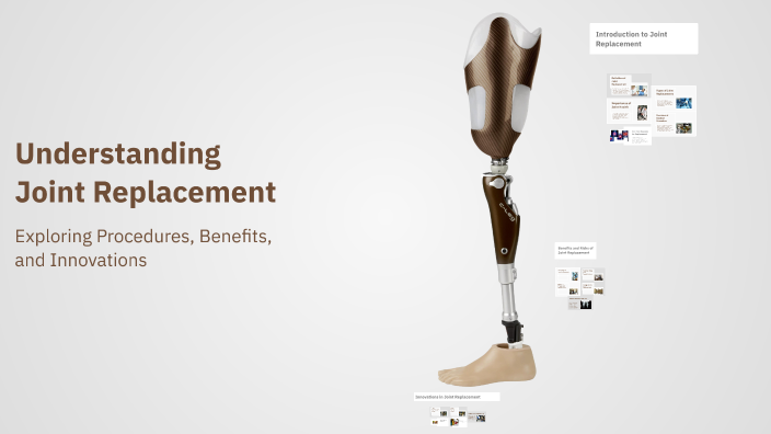 Understanding Joint Replacement by emily Livermore on Prezi