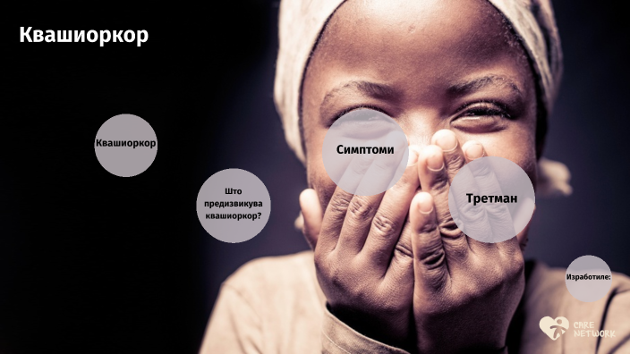 Квашиоркор by Filip Velkov on Prezi