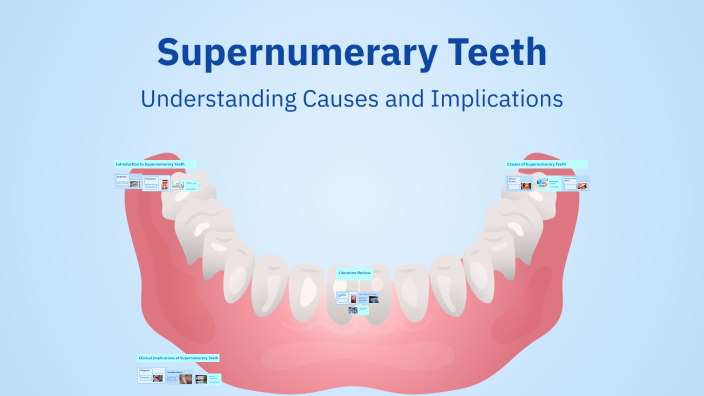 Supernumerary Teeth by Judi Sam on Prezi