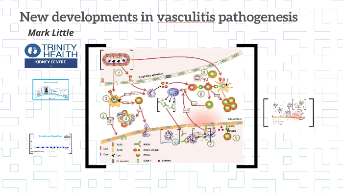 New developments in vasculitis pathogenesis CV society by Mark Little ...