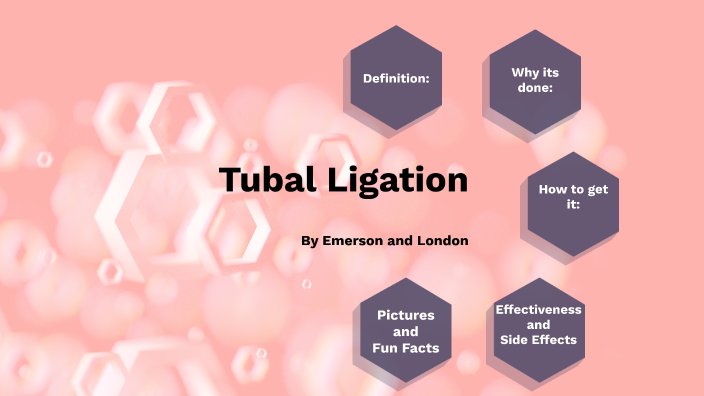 Tubal Ligation by Emerson Abcarian on Prezi