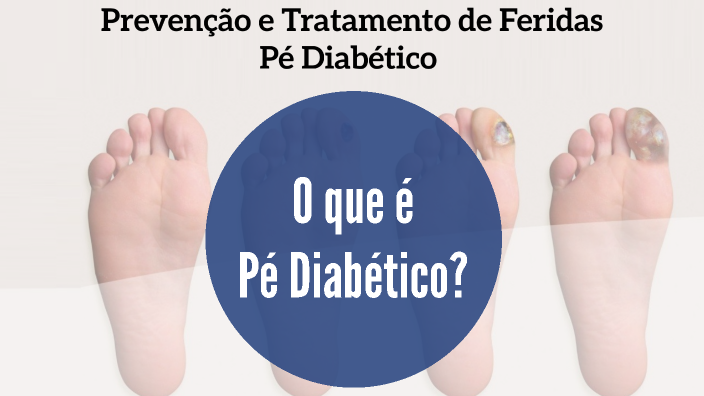 Prevenção e tratamento do Pé Diabético by Jennifer Belinski on Prezi