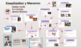 Kwashiorkor y Marasmo by natalia rovelo on Prezi
