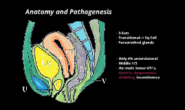 Urethral Diverticulum by Shawn Watts on Prezi
