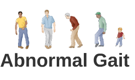 Abnormal Gait by Deema A on Prezi