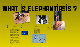 Elephantiasis by Trevor Witkowski on Prezi